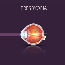 Presbyopia Flowood | Ophthalmologist Jackson | Mississippi Vision