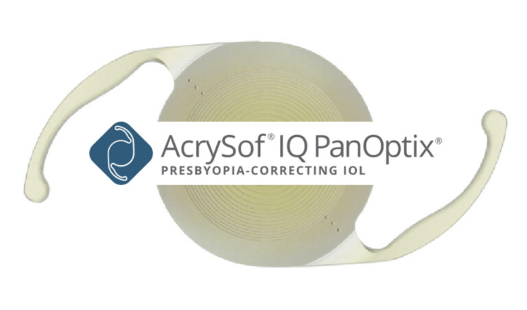 Cataracts Jackson | PanOptix Trifocal IOL | Mississippi Vision