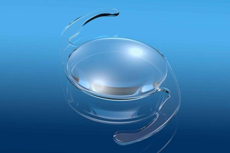 Cataract Surgery Jackson | Vivity™ IOL | Mississippi Vision