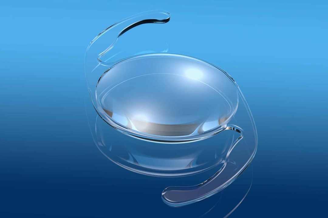 Cataract Surgery Jackson | Vivity™ IOL | Mississippi Vision